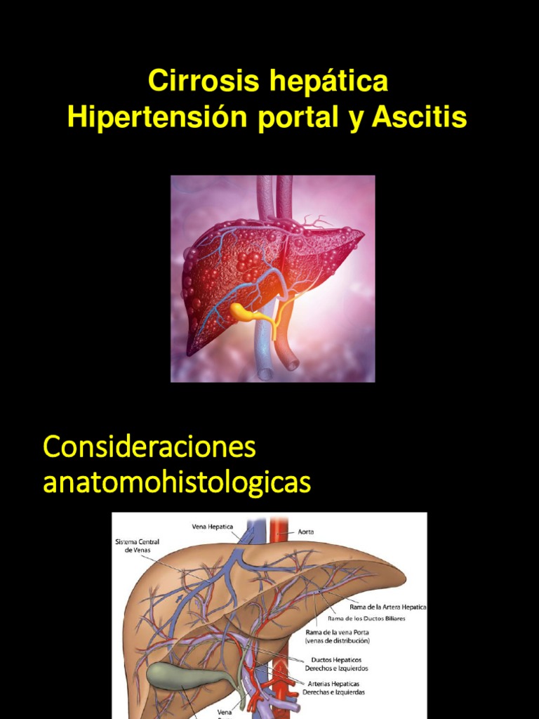 Cirrosis Hepática | PDF | Cirrosis | Hipertensión