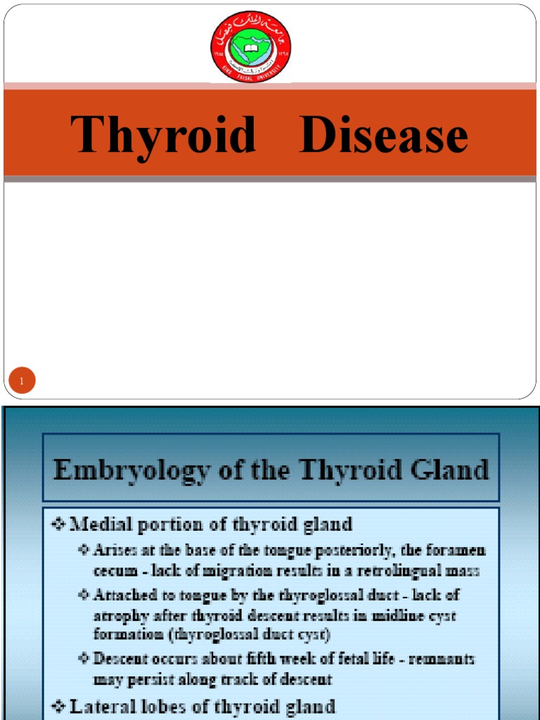Benign Thyroid Diseases Nabeeh | PDF | Thyroid | Hyperthyroidism