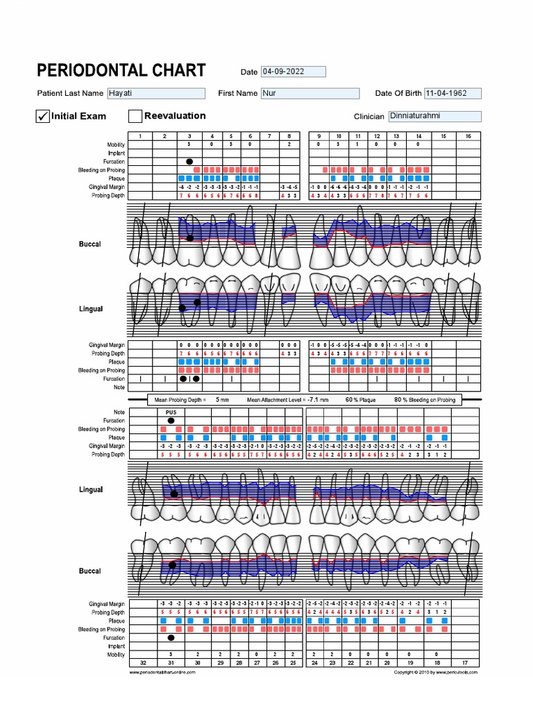 Chart Periodontal | PDF