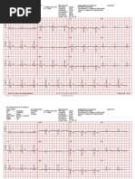 Normal Pediatric Echocardiogram Report | PDF