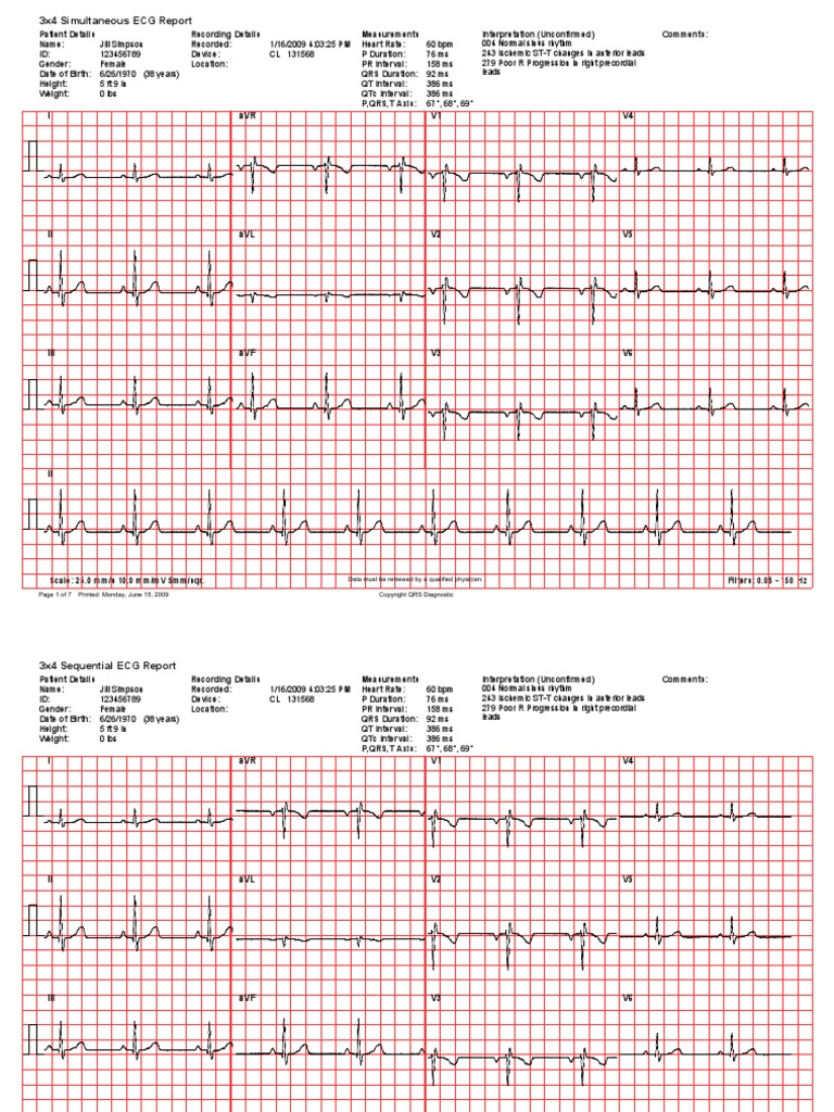 Universal ECG Sample Reports | PDF | Electrocardiography | Heart