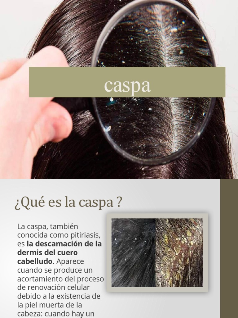 Caspa | PDF | Dermatología | Condiciones cutáneas