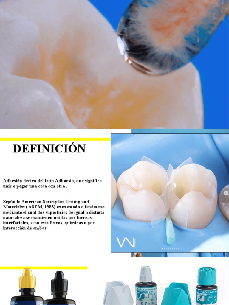 Expo Adhesion | PDF | Esmalte de dientes | Adhesión