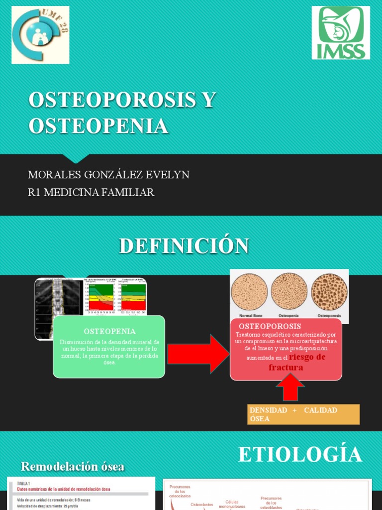 Osteoporosis y Osteopenia | PDF | Osteoporosis | Hueso