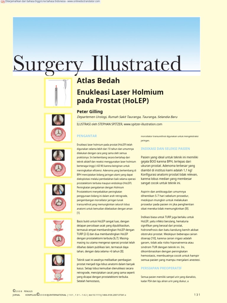 BJUI HoLEP Guidelines Monograph - En.id | PDF