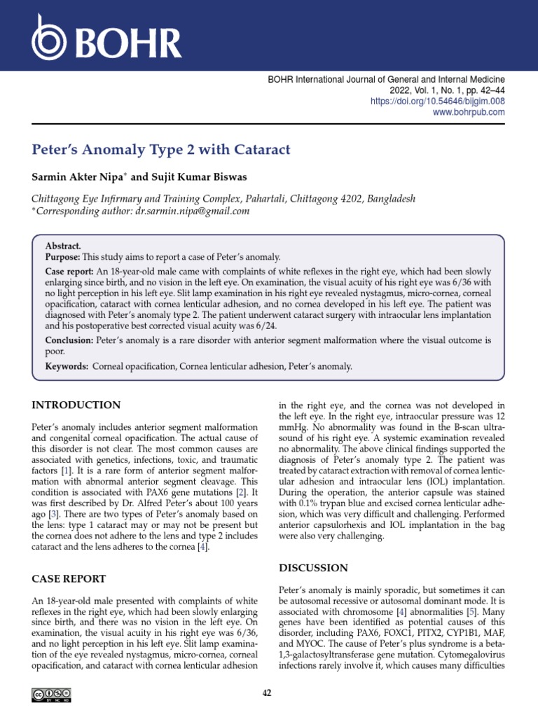 Peter's Anomaly Type 2 With Cataract | PDF