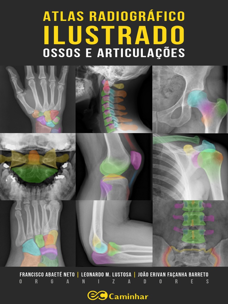 Atlas Radiografico Ilustrado | PDF | Coluna vertebral | Mão