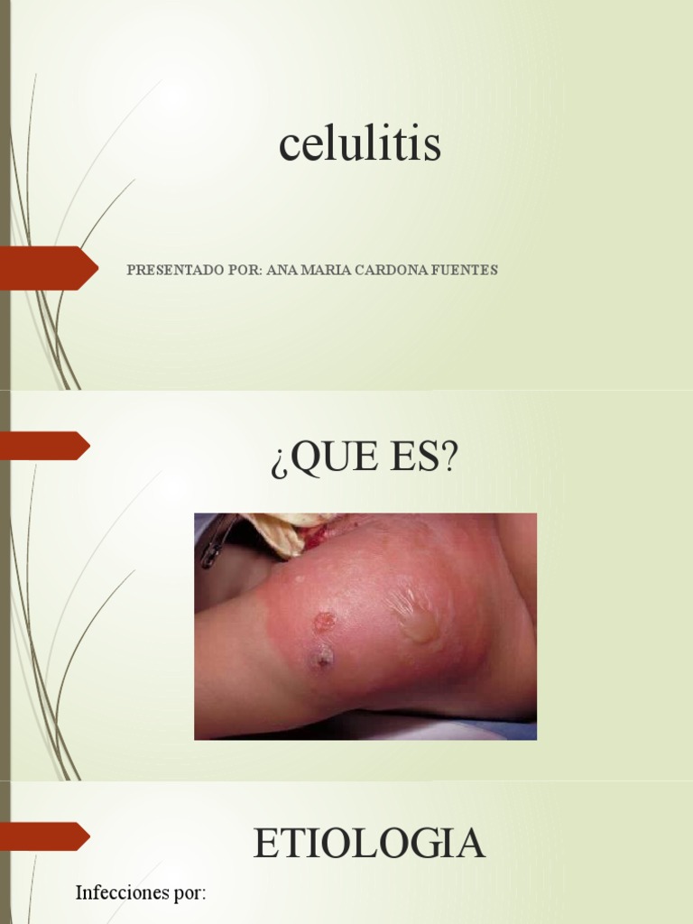 Celulitis en pierna izquierda en paciente de 30 años tras picadura de ...