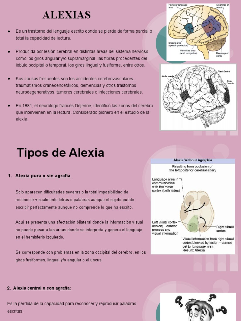 Alexias, Agrafias y Acalculia | PDF | Afasia | Lóbulo temporal