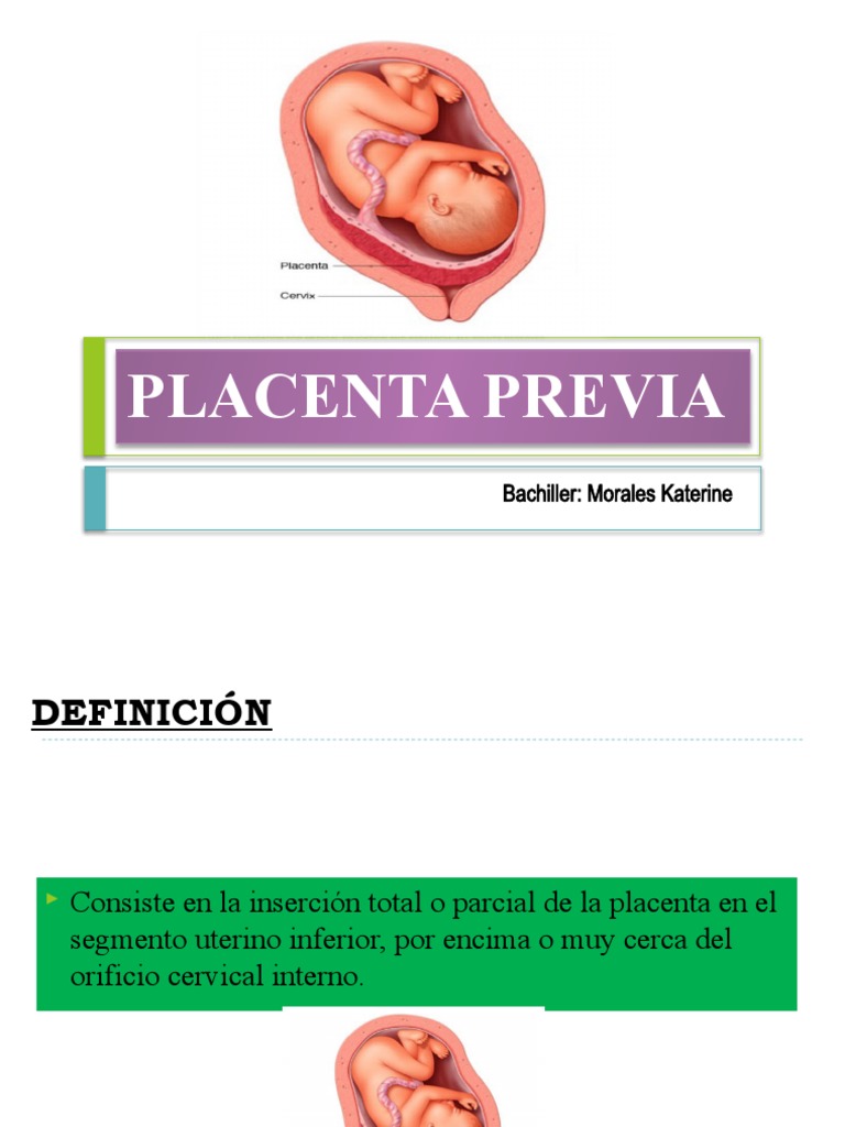 Clasificación y manejo de placenta previa | PDF | Parto | El embarazo