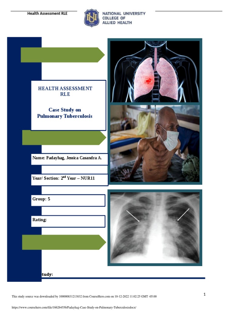 Padayhag Case Study On Pulmonary Tuberculosis | PDF | Tuberculosis ...
