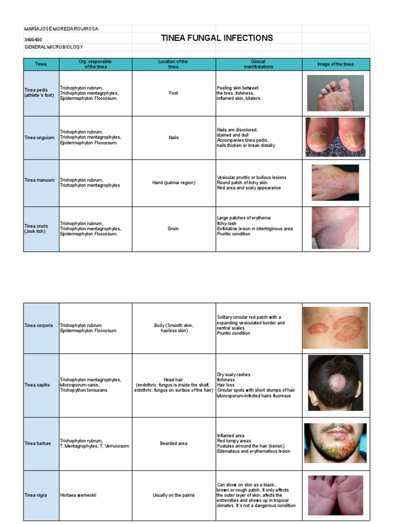 Tinea fungal infections - Hoja 1 | PDF | Fungus | Immunology