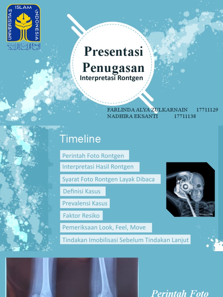 Interpretasi Hasil Foto Rontgen Fraktur Supracondylar Humerus Sinistra pada Anak | PDF