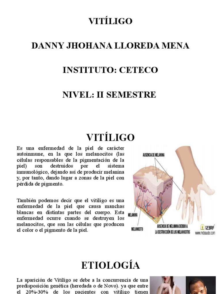 VITÍLIGO | PDF | Medicina | Enfermedades y trastornos