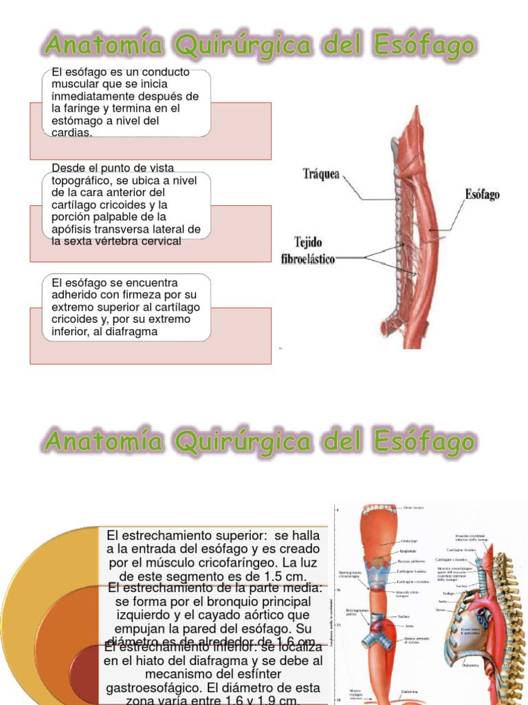 Esofago ERGE Hernia Hiatal | PDF | La enfermedad por reflujo ...