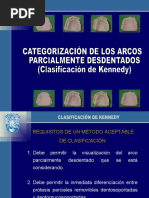 Clasificacion Kennedy y Reglas de Applegate | PDF | Palanca