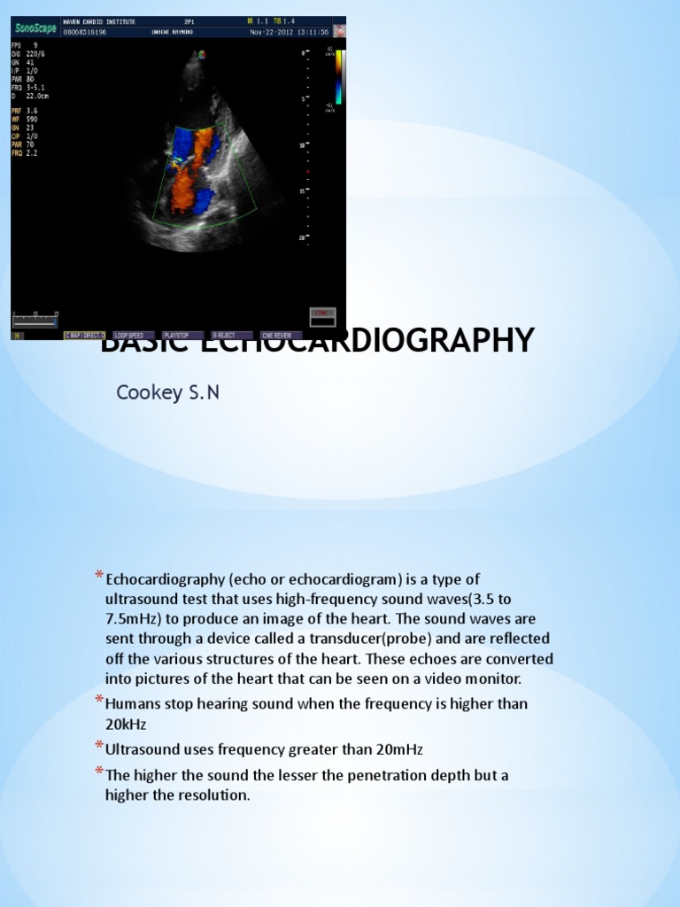 Basic Echocardiography | PDF | Echocardiography | Medical Ultrasound