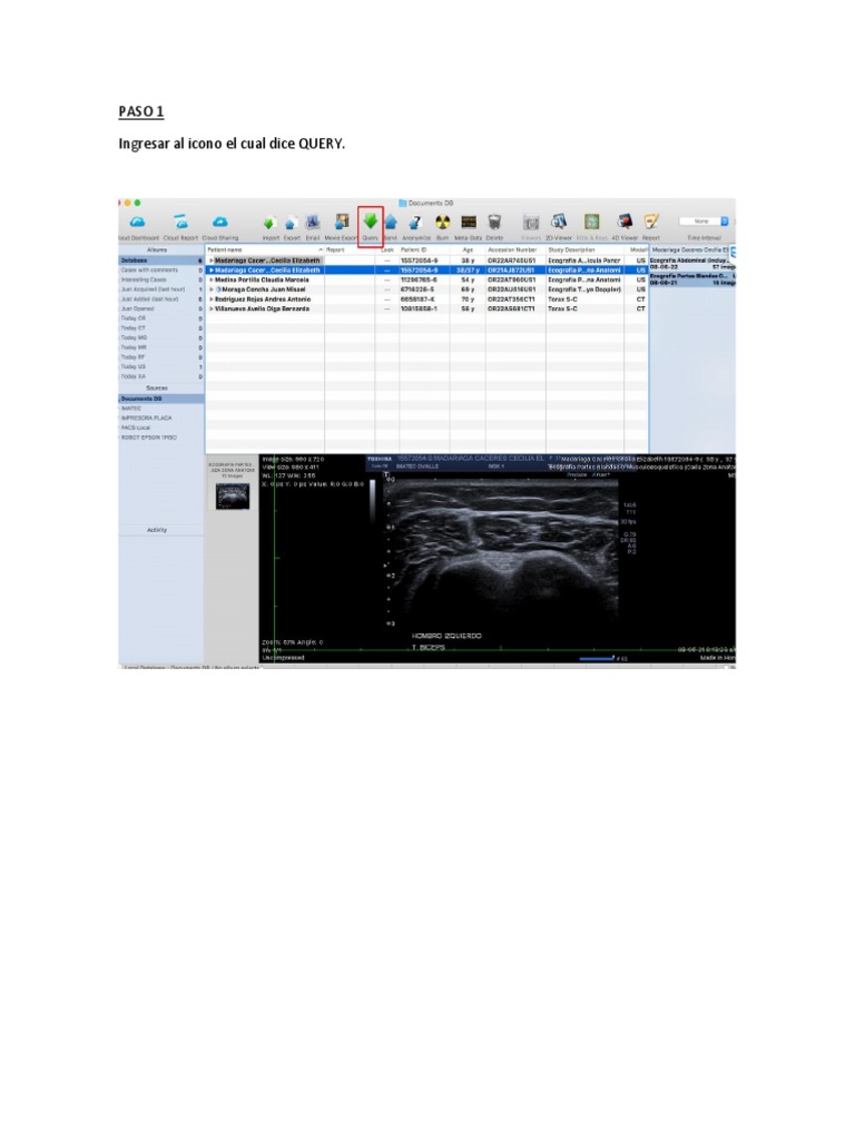 Tutorial Como Buscar Estudios en PACS | PDF | Informática