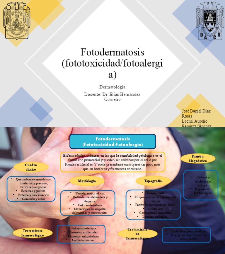 Fotodermatosis (Fototoxicidad-Fotoalergia) | PDF | Causas de la muerte ...