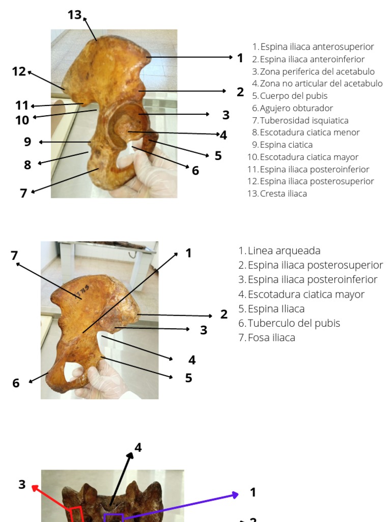 Anatomia 2 Pelvis y Perine | Descargar gratis PDF | Sistema ...