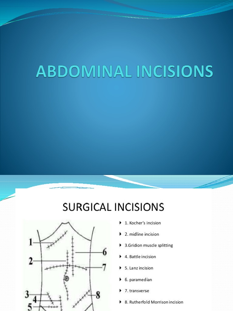 Types of Abdominal Incisions Explained | PDF | Abdomen | Anatomy