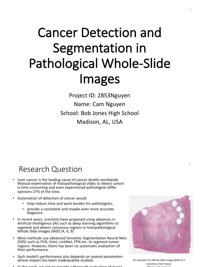 Cancer Detection and Segmentation Project PPT Compressed | PDF | Image ...
