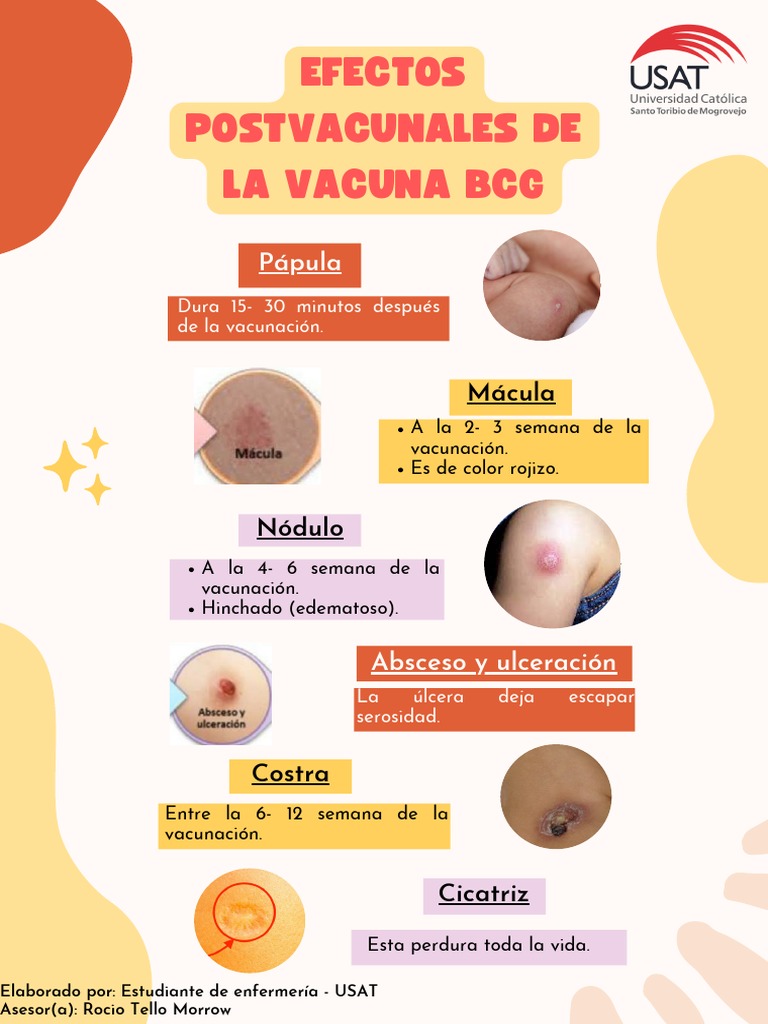 Efectos Postvacunales de La Vacuna BCG | PDF