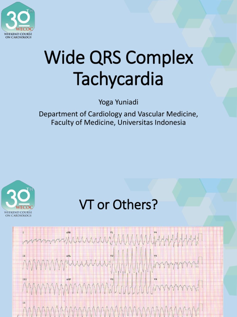 Yoga Yuniadi - Wide QRS Complex Tachycardia - Baru | PDF ...