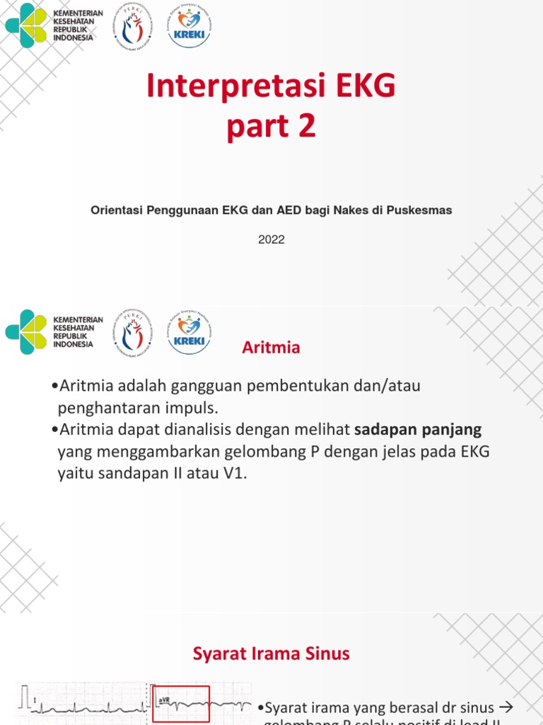 Interpretasi EKG 2 (Aritmia Dan SKA) | PDF