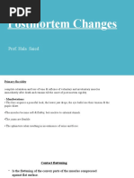 Cadaveric Spasm: Forensic Significance | PDF