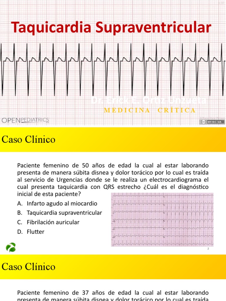 Taquicardia Supraventricular | PDF | Electrocardiografia ...