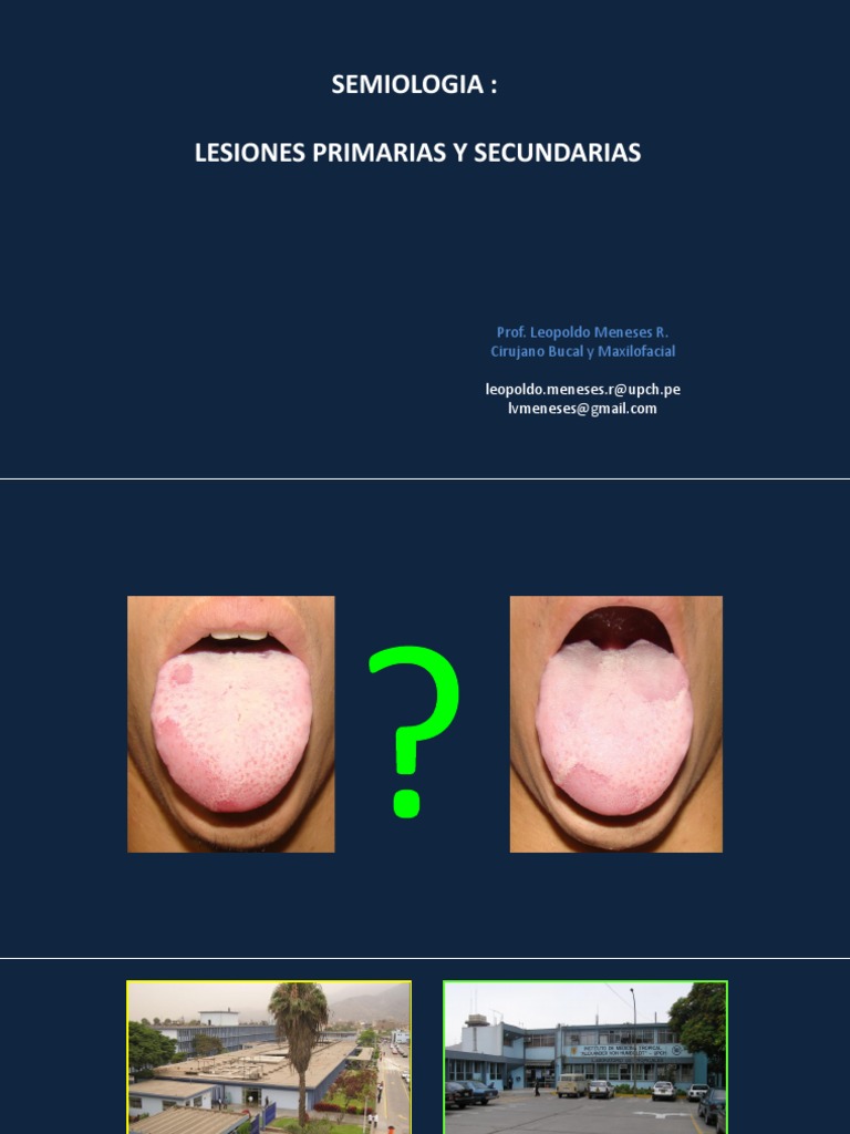 Lesiones Primarias y Secundarias en Semiótica | PDF | Cirugía Oral y ...