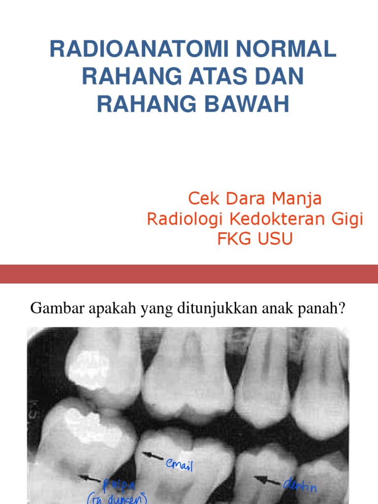 RD 5.7 Gambaran Radiografi Anatomi Normal Dan Patologis Dan Teknik ...