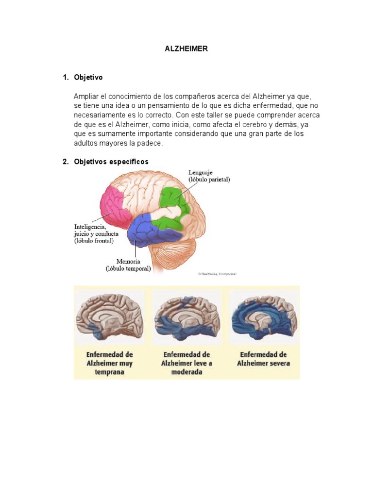 Comprendiendo el Alzheimer y sus etapas | PDF | Enfermedad de Alzheimer ...