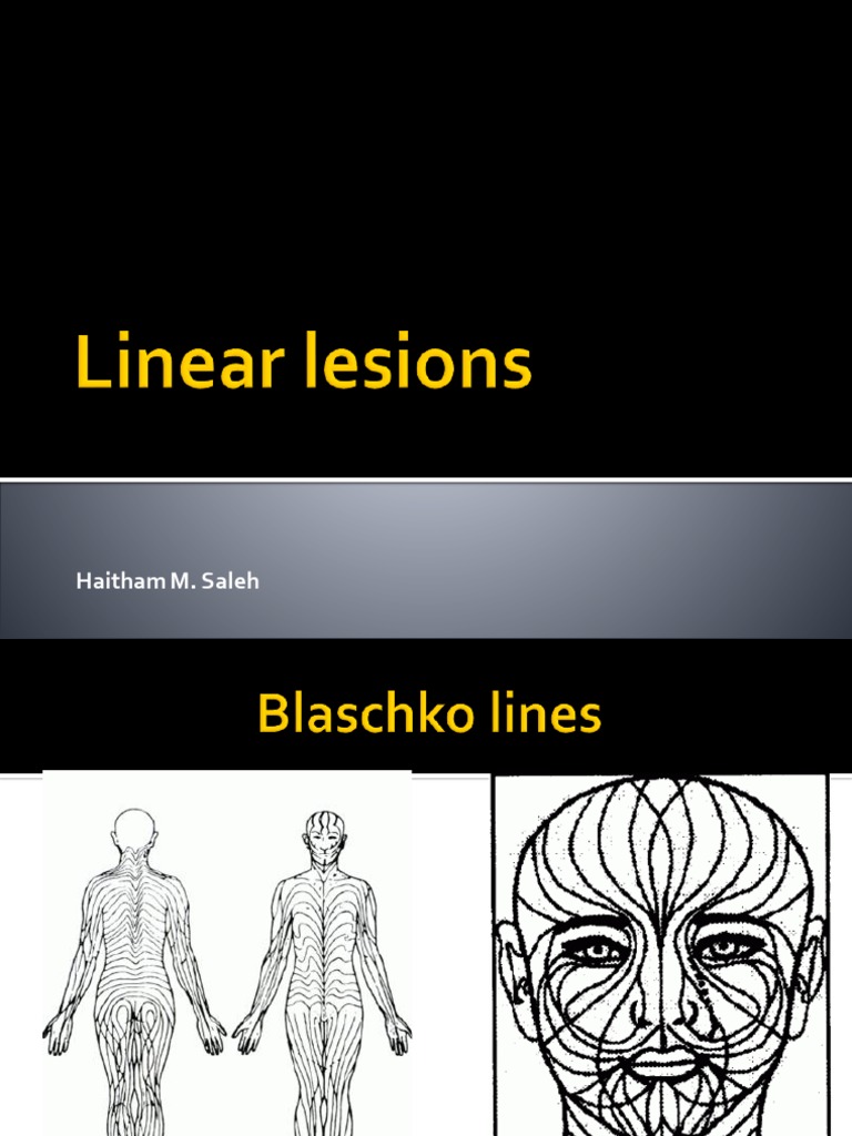 Linear Lesions | PDF | Cutaneous Conditions | Causes Of Death