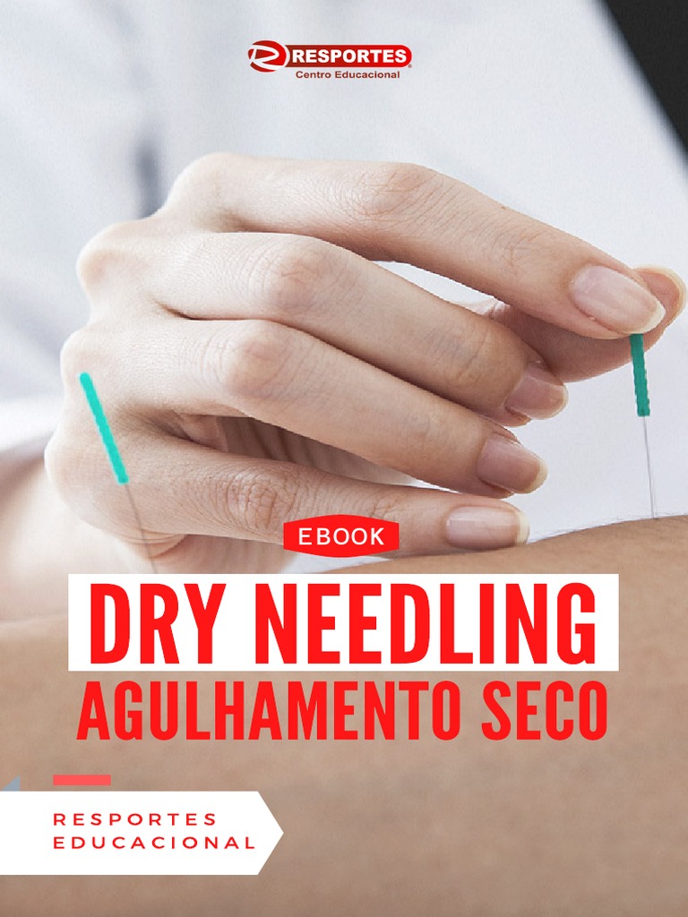 Ebook Dry Needling | PDF