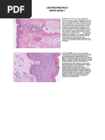Guía Completa de Colposcopia y NIC | PDF | Especialidades Medicas ...