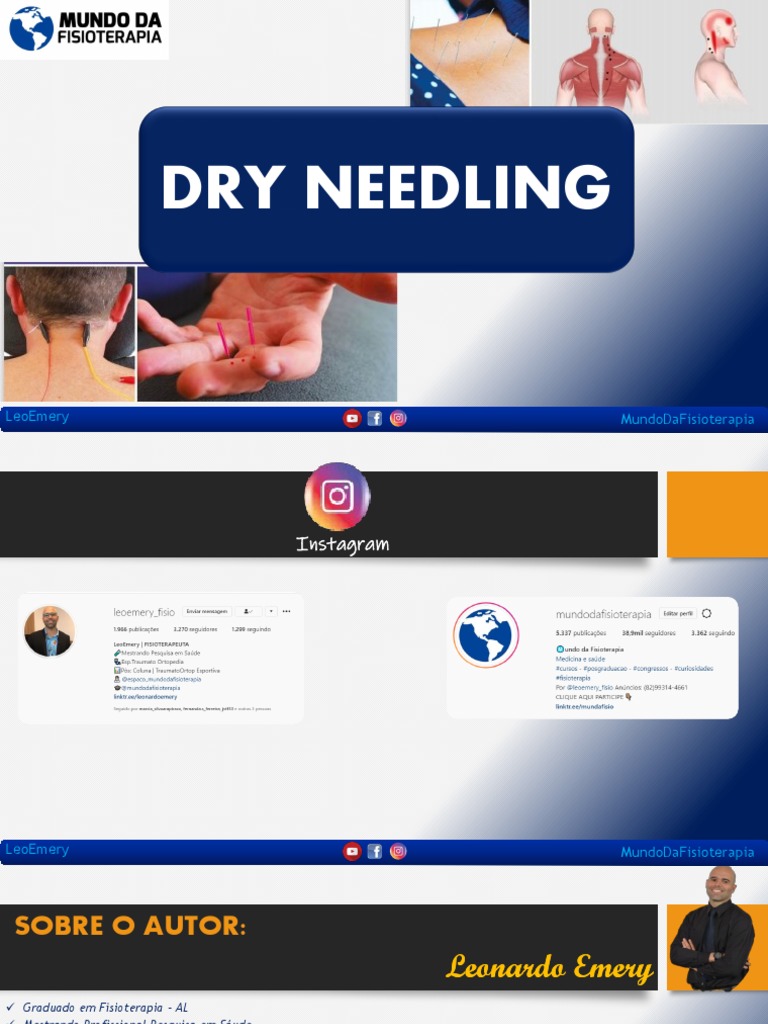 Apostila Dry Needling Curso | PDF | Dor | Fibromialgia