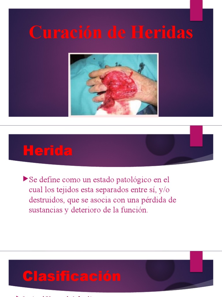 Curación de Heridas | PDF | Herida | Cicatrización de la herida
