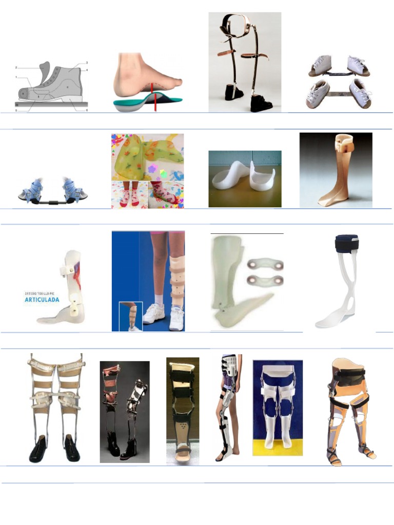 Ortesis Imagenes | PDF