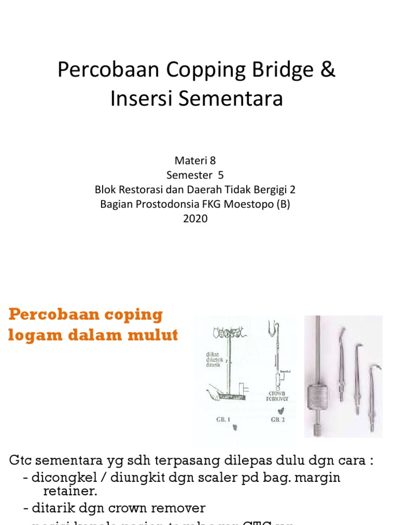 Percobaan Insersi Crown dan Coping Bridge | PDF