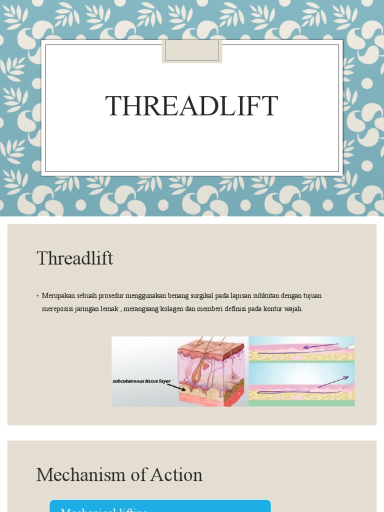 Threadlift: Procedure and Considerations | PDF