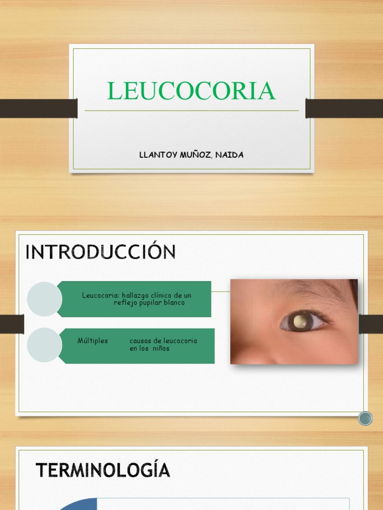 LEUCOCORIA | PDF | Imagen de resonancia magnética | Medicina CLINICA
