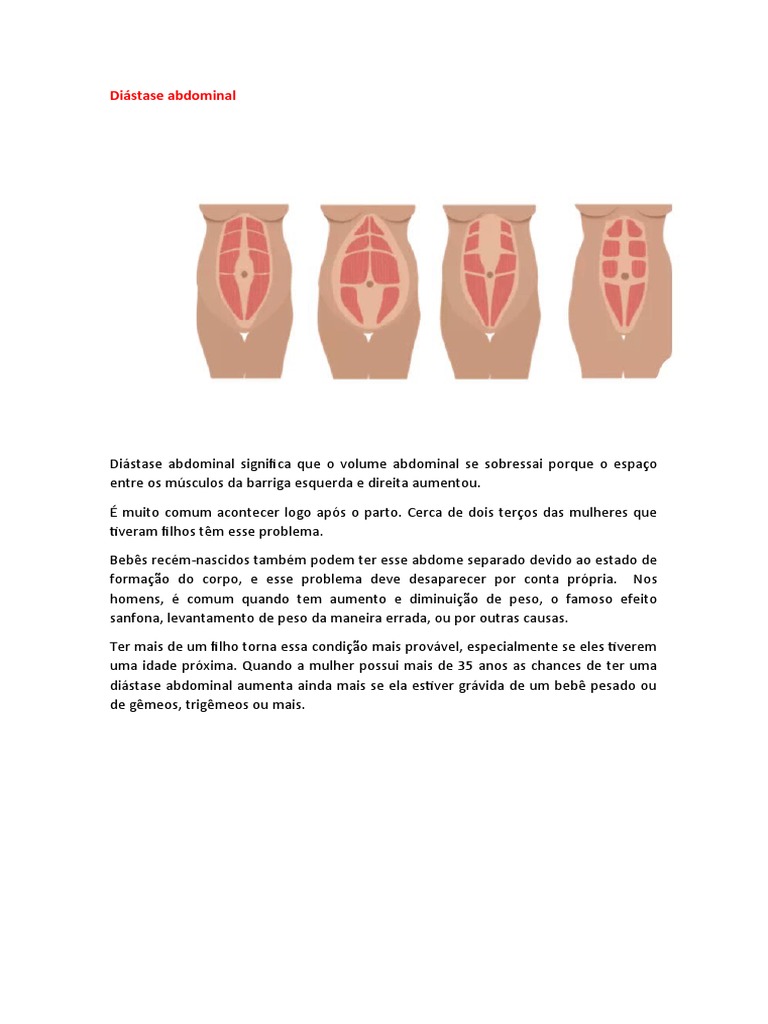 Diástase Abdominal | PDF | Gravidez | Músculo esquelético