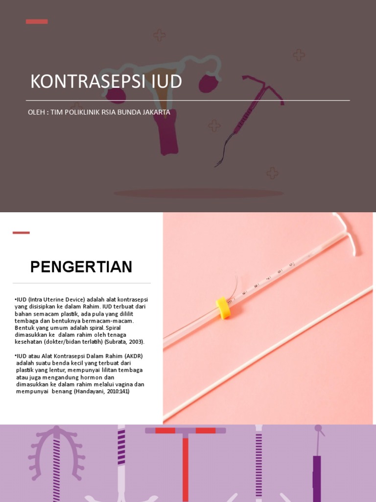 Iud Fix | PDF
