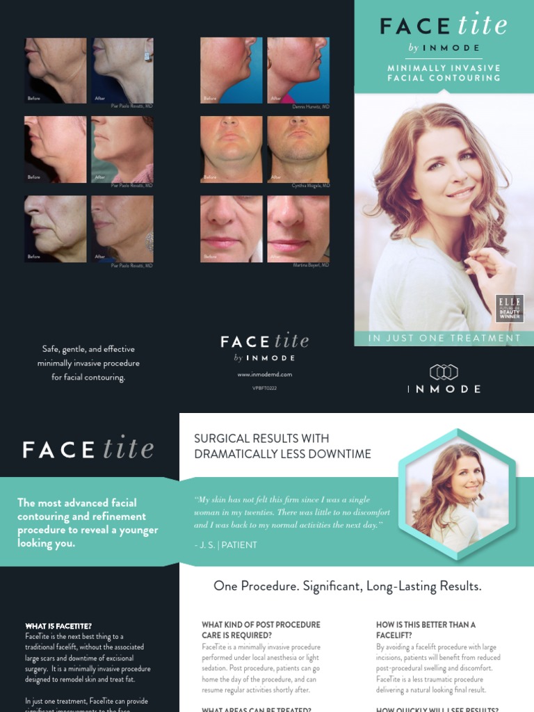 FaceTite: Minimally Invasive Facial Contouring | PDF | Surgical ...