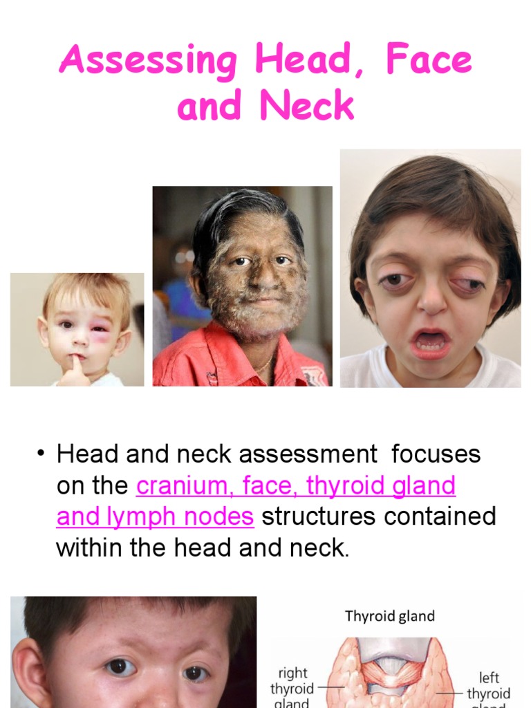 Head, Face, and Neck Assessment Guide | PDF | Skull | Human Nose