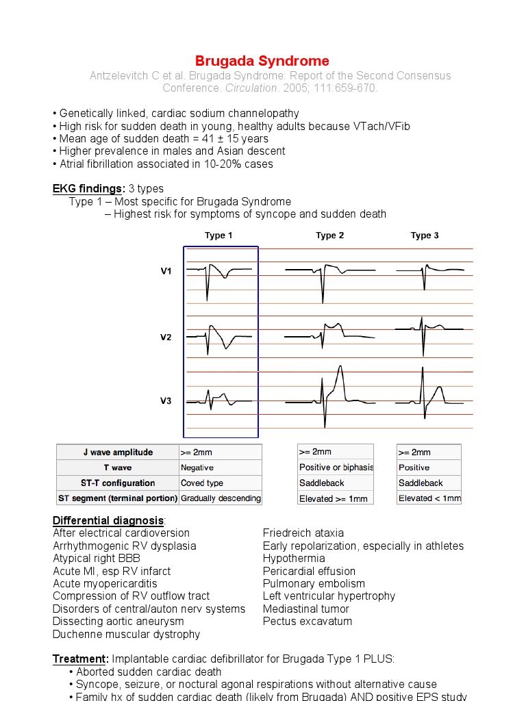 Brugada Syndrome | PDF | Cardiac Arrest | Cardiology
