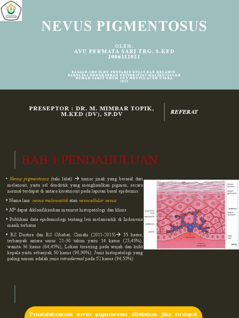 KLASIFIKASI NEVUS PIGMENTOSUS | PDF