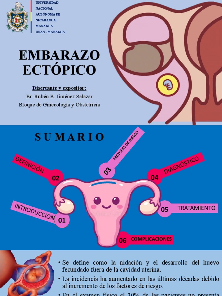 Embarazo Ectópico | PDF | El embarazo | Salud pública